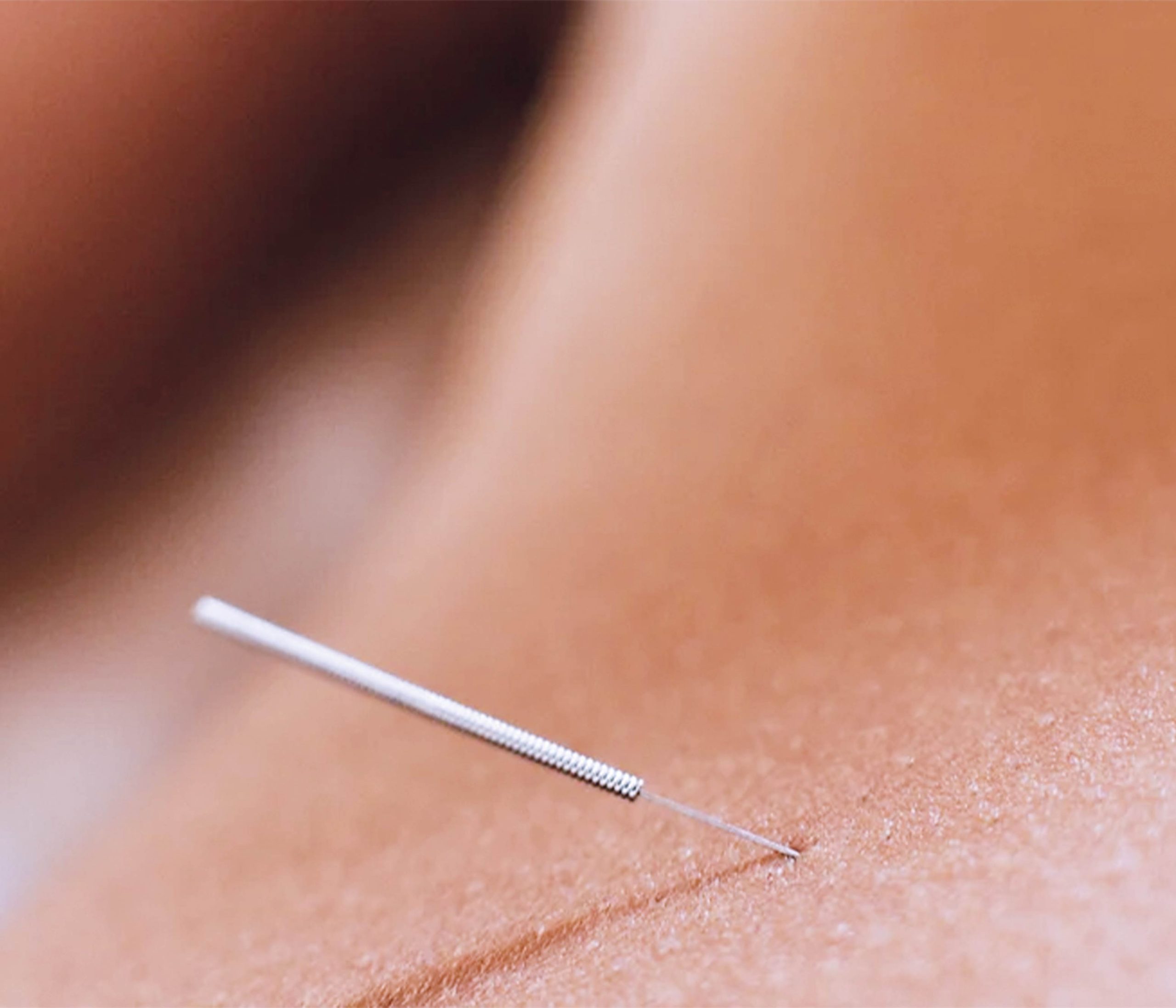 Home - Elumin Acupuncture